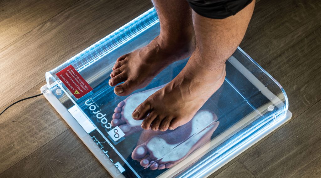 Flat Feet & Fallen Arches Treatment Sydney | WTW Podiatry